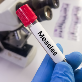 Measles Antibody Test | Raffles Health Singapore